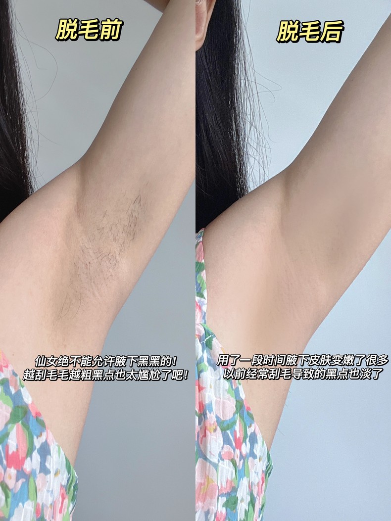 Ulike蓝宝石红光嫩肤冰点脱毛仪UI05评测 Ulike脱毛仪怎么样